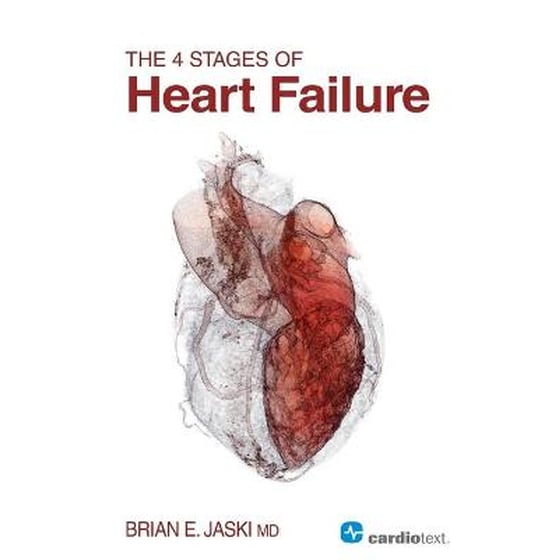 The 4 Stages of Heart Failure - Jaski~Brian E. | Public βιβλία